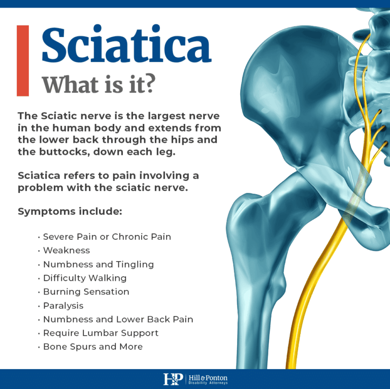 Is Sciatica a Disability? Understanding Social Security Disability ...
